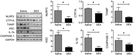 The protein expression levels of NLRP3 CTP1A TXNIP ASC IL 1β and