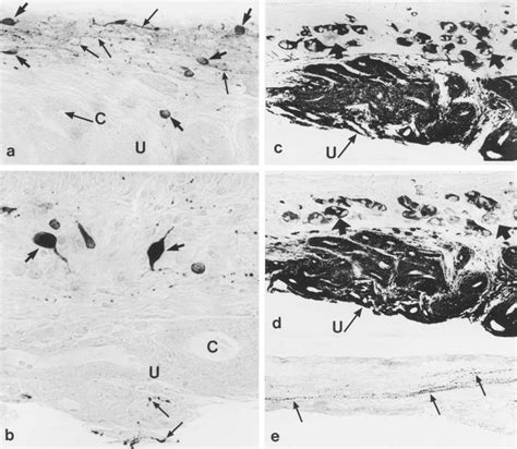 A E Sagittal Sections Through The Urophyseal Region Immunostained For