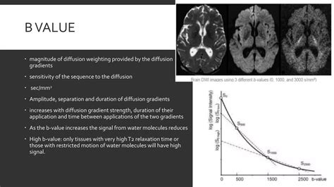 Mri Diffusion Pptx