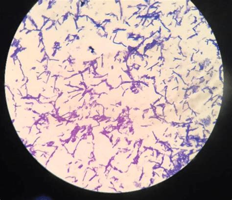 Bacillus Subtilis Gram Stain Positive Or Negative