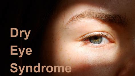 Dry Eye Syndrome Effective Treatments And Prevention Tips