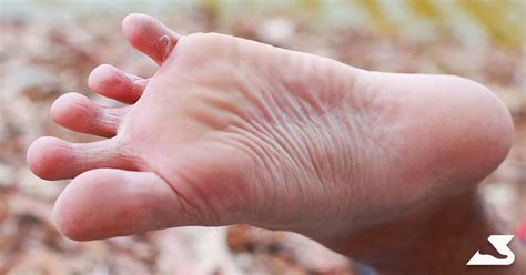 Common Contagious Toe Conditions Fungus Or Bacteria