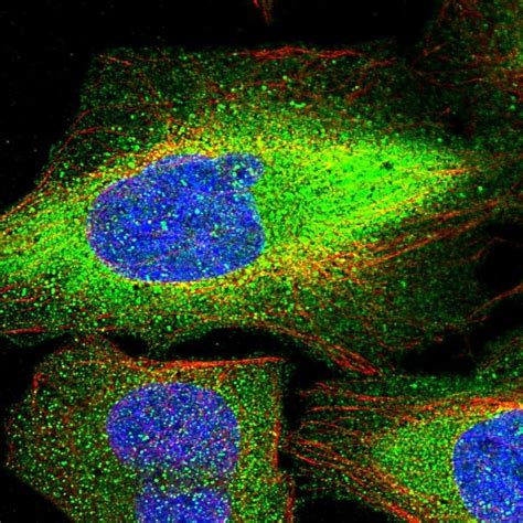 Integrin Beta 7 Antibody Pa5 83600
