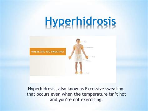 Ppt Hyperhidrosis Treatment Powerpoint Presentation Free Download