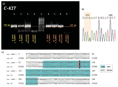 Electrophoretic Evaluation Of The Amplification Of C Kit Gene Download Scientific Diagram