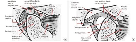 The Anatomy Of Temporo Mandibular Joint A Tmj State At Mouth Closing