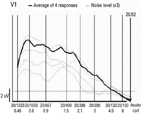 This Graph Shows The Vector Average Of The Different Sweep Responses