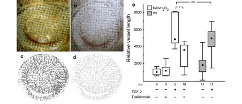 Semi Automated Quantification Of Neovessel Density A D Successive