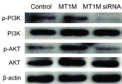 Effect Of Mt1m Regulation On Pi3kakt Signaling Pathway In Rgc 5 Cells