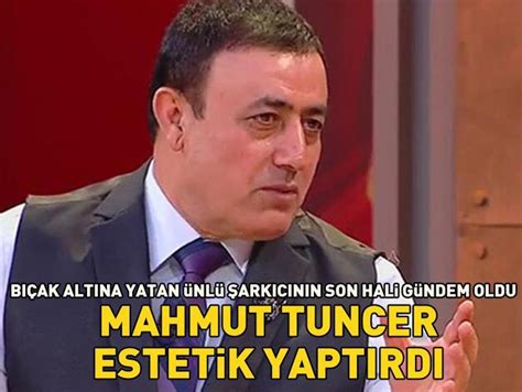 O da estetikli ünlüler kervanına katıldı Mahmut Tuncer bıçak altına