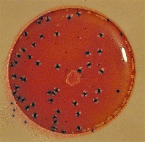 Ocean Guardians E Coli And Coliform