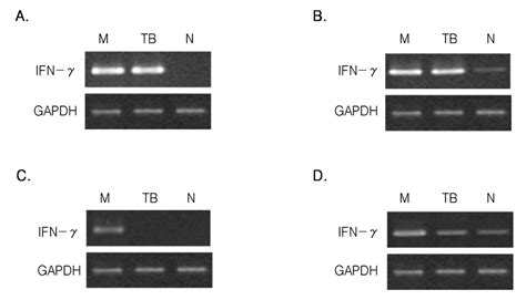 The IFN γ mRNA RT PCR results in active TB patients blood samples A Download Scientific