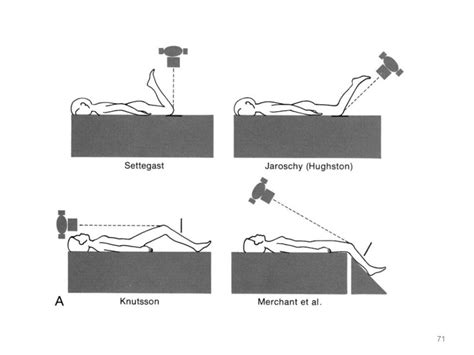 Radiographic Positioning Examples Of The Knee Patella Views Ce4rt