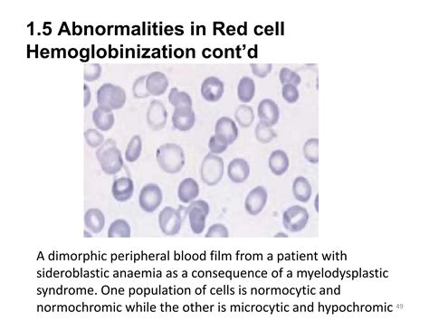 Hema Ii Chapter Rbc Morphology Study At Ppt
