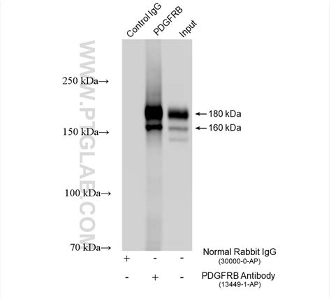 Pdgfr Beta Cd140b Antibody 13449 1 Pbs Proteintech