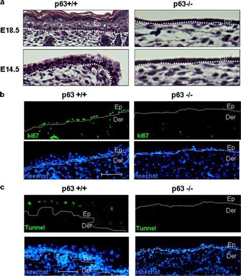 ΔNp is an ectodermal gatekeeper of epidermal morphogenesis Cell Differentiation