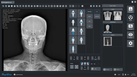 Digital Radiography Acquisition Software Astel Inc