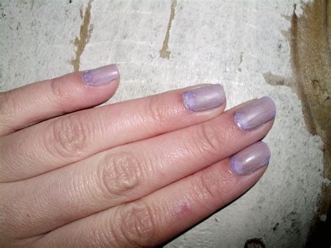 Just Skin Bones And Nails Dead Nails