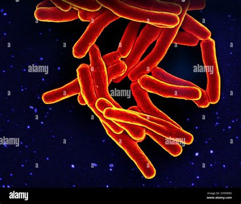 Scanning Electron Micrograph Of Mycobacterium Tuberculosis Particles Colorized Red And Yellow