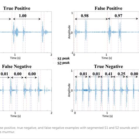 Figure E Roc Curve For The Stills Murmur Identification Algorithm
