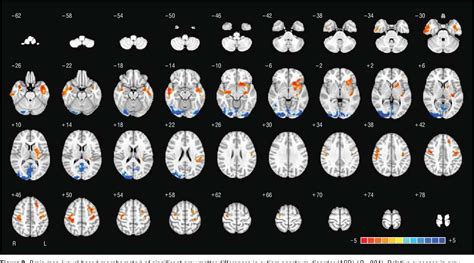 Figure 2 From Brain Anatomy And Its Relationship To Behavior In Adults