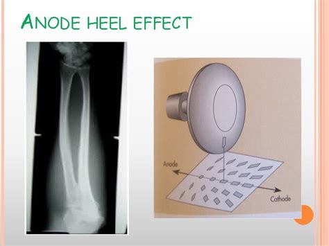 X Ray Tubes By Dr Monica Patil Introduction