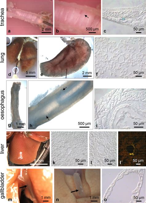 Olfactory Receptor Olfr78 Prostate Specific G Protein Coupled Receptor