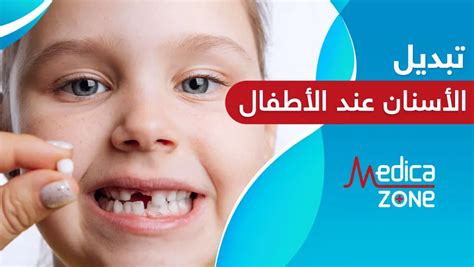 ما هي أسباب تاخر تبديل الاسنان عند الاطفال؟