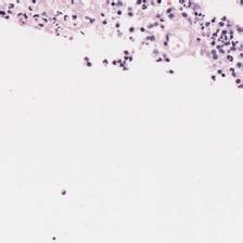 Missing Features Tiles Problem Issue Katherlab Preprocessing Ng Github