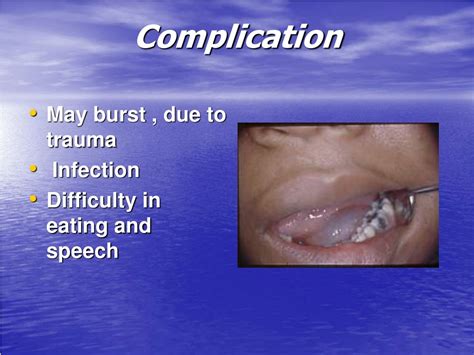 Ppt Differential Diagnosis Of Cystic Neck Swellings And Their