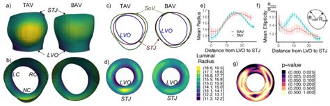 Ab The Average Reference Shape Of Aortic Root For Patients With Tav Download Scientific