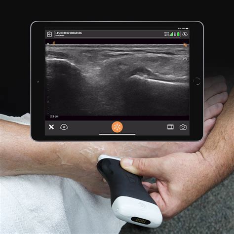Clarius Mobile Health On Linkedin Musculoskeletal Ultrasound