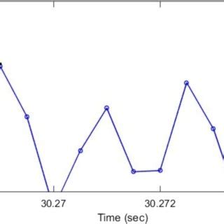 General Topology Of Our Model The First Part Is Sleep Apnea ECG Signal Download Scientific