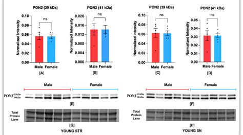 Young Nhp Brain Has No Sex Bias In Pon2 Isoforms Expression In Str And