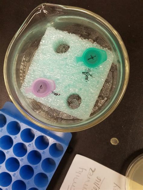 Bacterial Transformation Lab Emilybiology