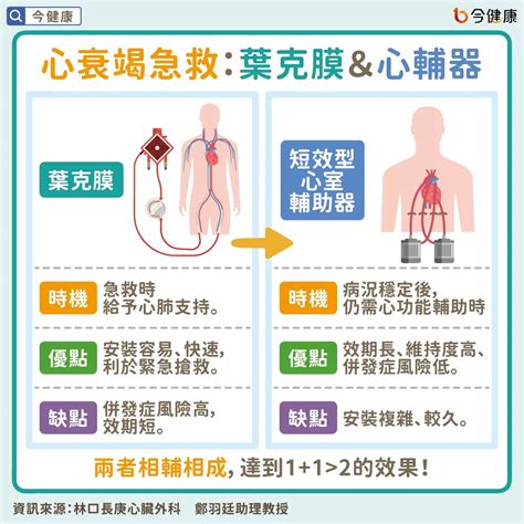 急救要用葉克膜還是心室輔助器？牢記「i Need Help」口訣，早發現、早治療！｜四季線上4gtv