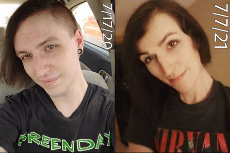 Its Been A Year Since I Started Hrt Been Really Happy With My