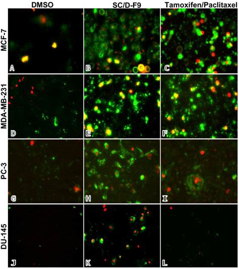 Apoptosis Of Breast And Prostate Cancer Cells By Scd F9 Tamoxifen And