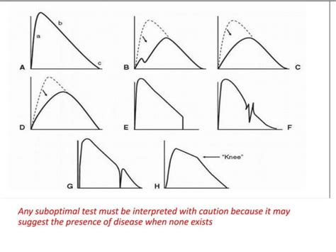 Common Pulmonary Functions And Interpretation Pptx