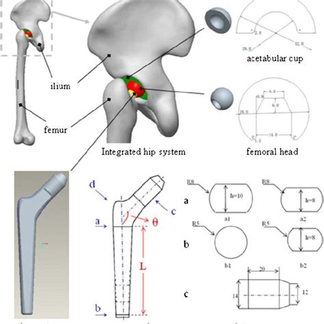 Pdf The Effect Of Stem Structure On Stress Distribution Of A Custom Made Hip Prosthesis