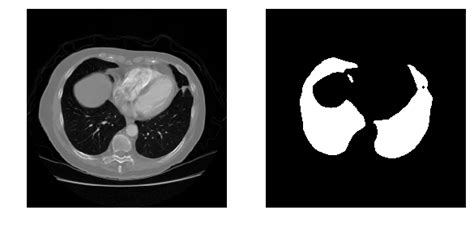 github eelvira lungsegmentation lung segmentation
