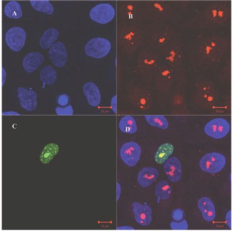 Co Localization Of Egfp Mlf1ip With Fibrillarin Hela Cells Were