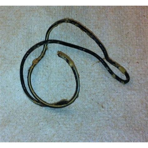 Electric Wire With Calcifications Removed By Bedside Cystoscopy