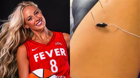 Sophie Cunningham Reveals She Has Herpes Video