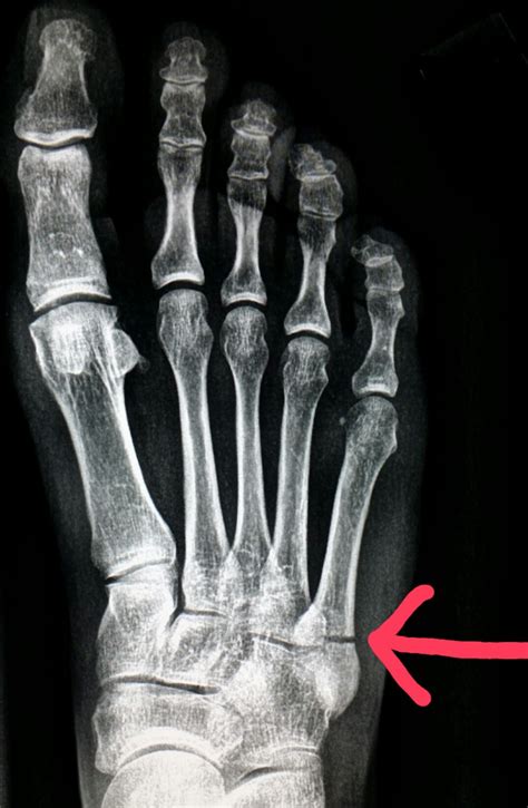 Pin On Radiology