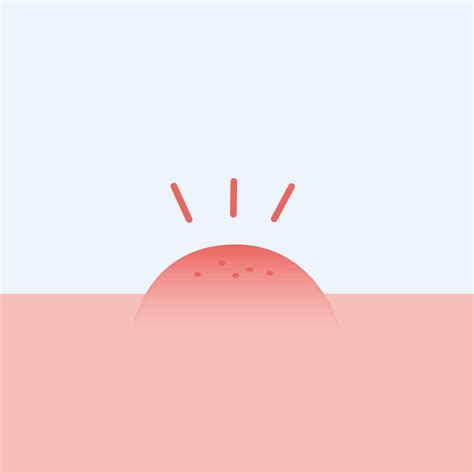 월경전 증후군pms