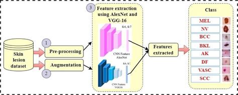 Steps For Classification Of Skin Disease Using Alexnet And Vgg 16 Download Scientific Diagram
