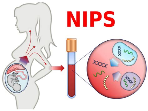 xét nghiệm nips là gì Đối tượng nào nên làm nips