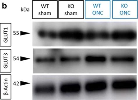 Glut3 Antibody Ja50 31 Nbp2 66872 Bio Techne