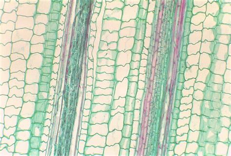 Yucca Stem Longitudinal Section Showing Secondary Wallstructure Of